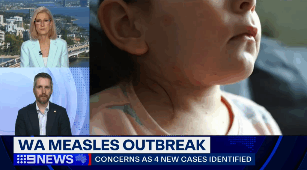 Vaccination best defence amidst increase in measles cases - Medicus